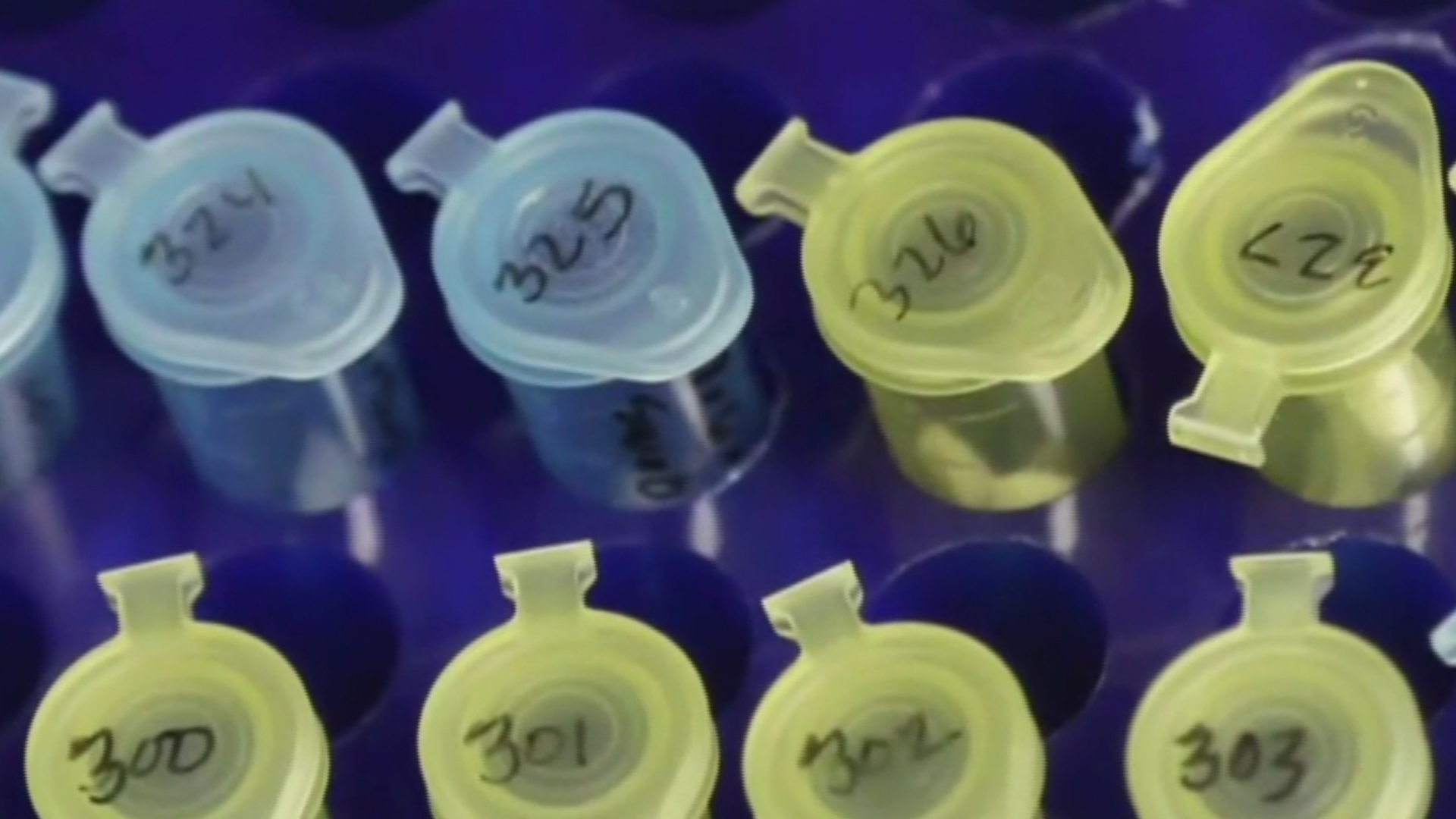 Watch CBS Evening News: Use of crime victim's DNA raises privacy ...