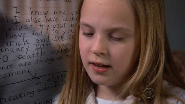 Watch CBS Evening News: Riley and Erin Kovalcik were born with a ...