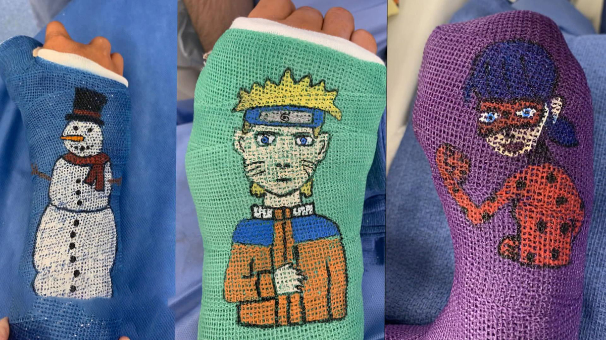 Watch CBS Evening News: Doctor gives pediatric patients custom cast art ...