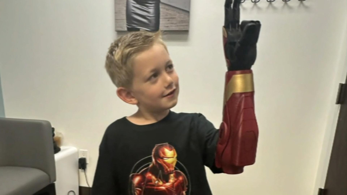 Watch CBS Evening News: Boy born without hand gets "Iron Man ...