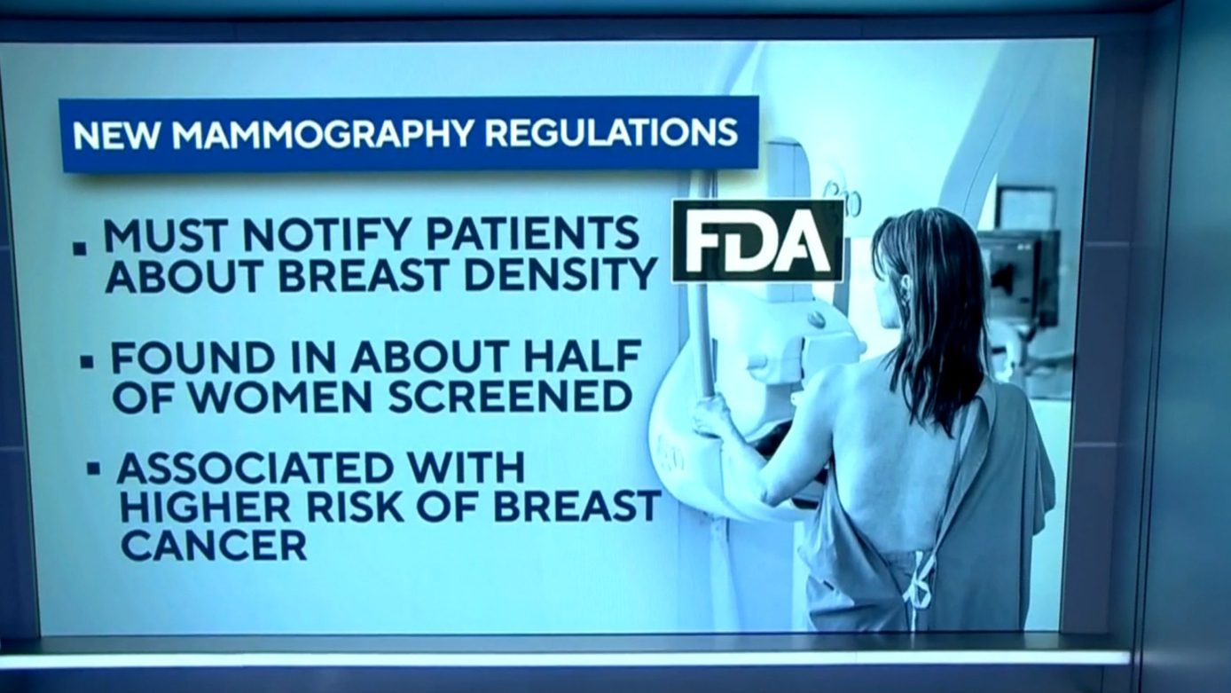 Watch Cbs Evening News Fda Unveils New Rules For Mammograms Full